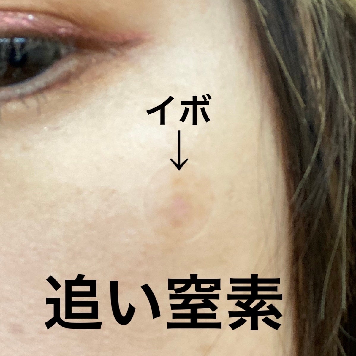 ハイチオールcプラス(医薬品)|エスエス製薬他、4商品を使った口コミ 皮膚科です。 アレルギー検査の結果、何もなしと。 By ためしたがり