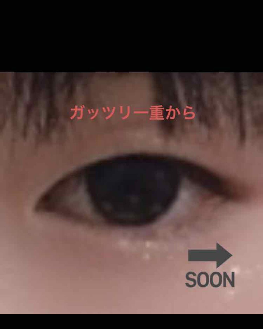 《二重になる方法》アイテープ 埋没式両面テープ|daisoの使い方や二重メイク 初投稿失礼します! 私2年前までガチガチの一重だったんです