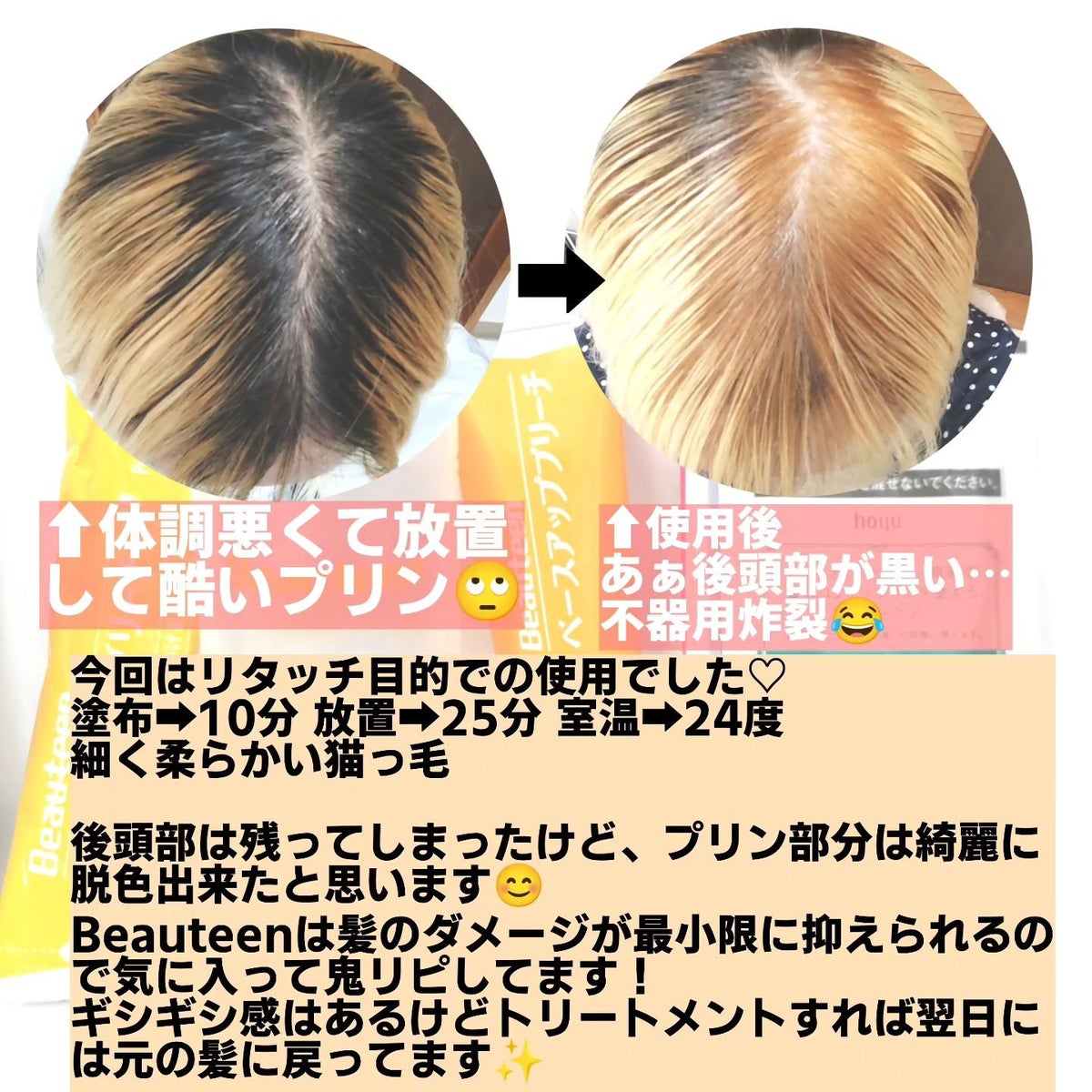 ベースアップブリーチ|ビューティーンの口コミ Hoyu Beauteen ベースアップブリーチ 500円前後店舗により異なる By