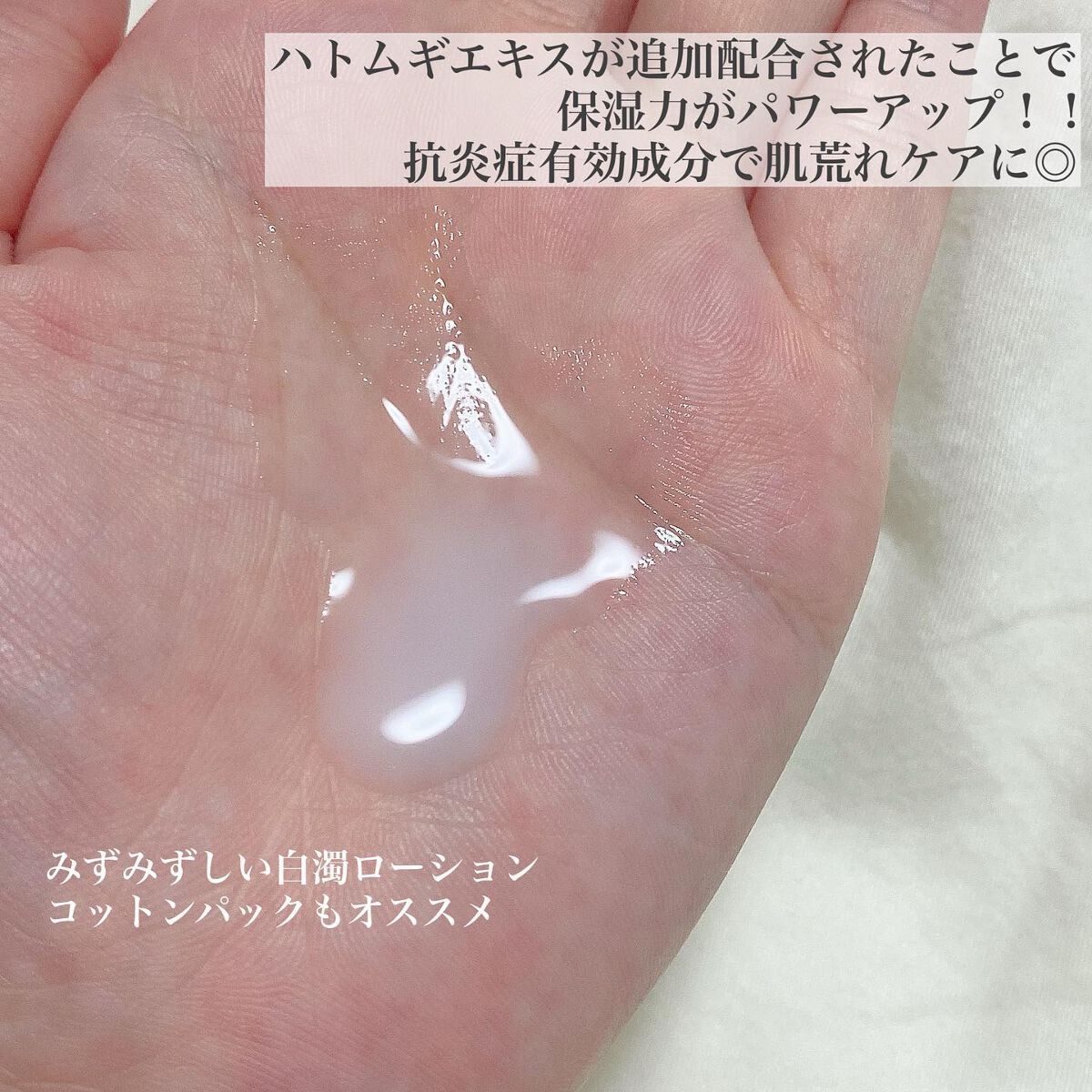 薬用スキンコンディショナーエッセンシャル N|albionの口コミ ニキビケアにおすすめの化粧水! 肌荒れの味方!スキコン待望の