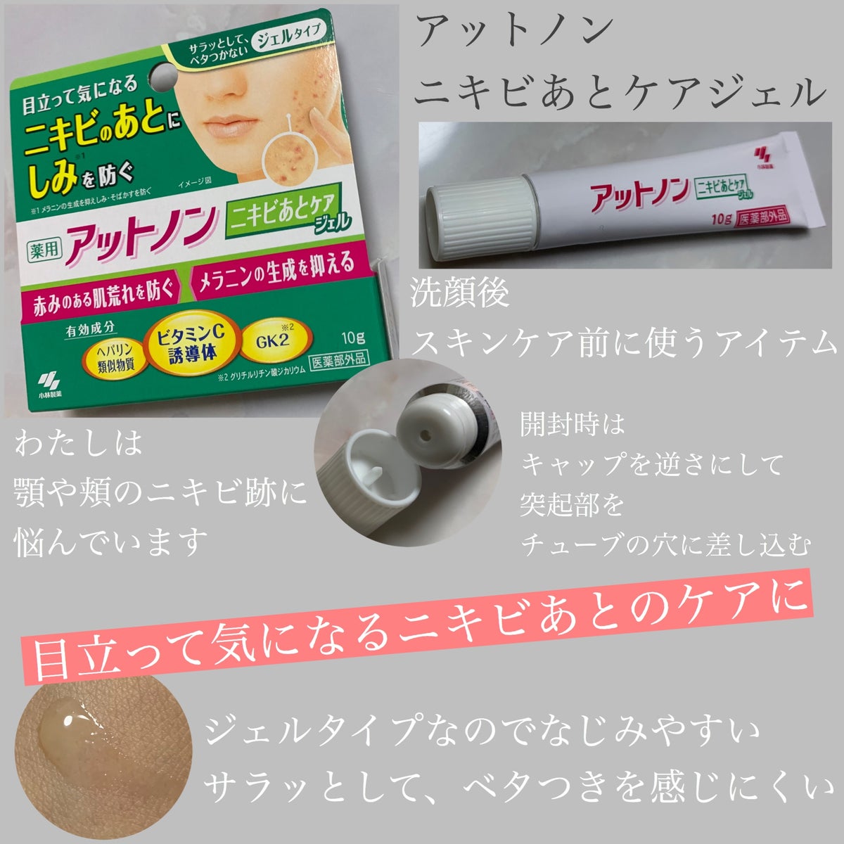ニキビあとケアジェル|アットノンの口コミ ニキビケアにおすすめのスキンケア!アットノンニキビあとケアジェル医薬部外品を使いました