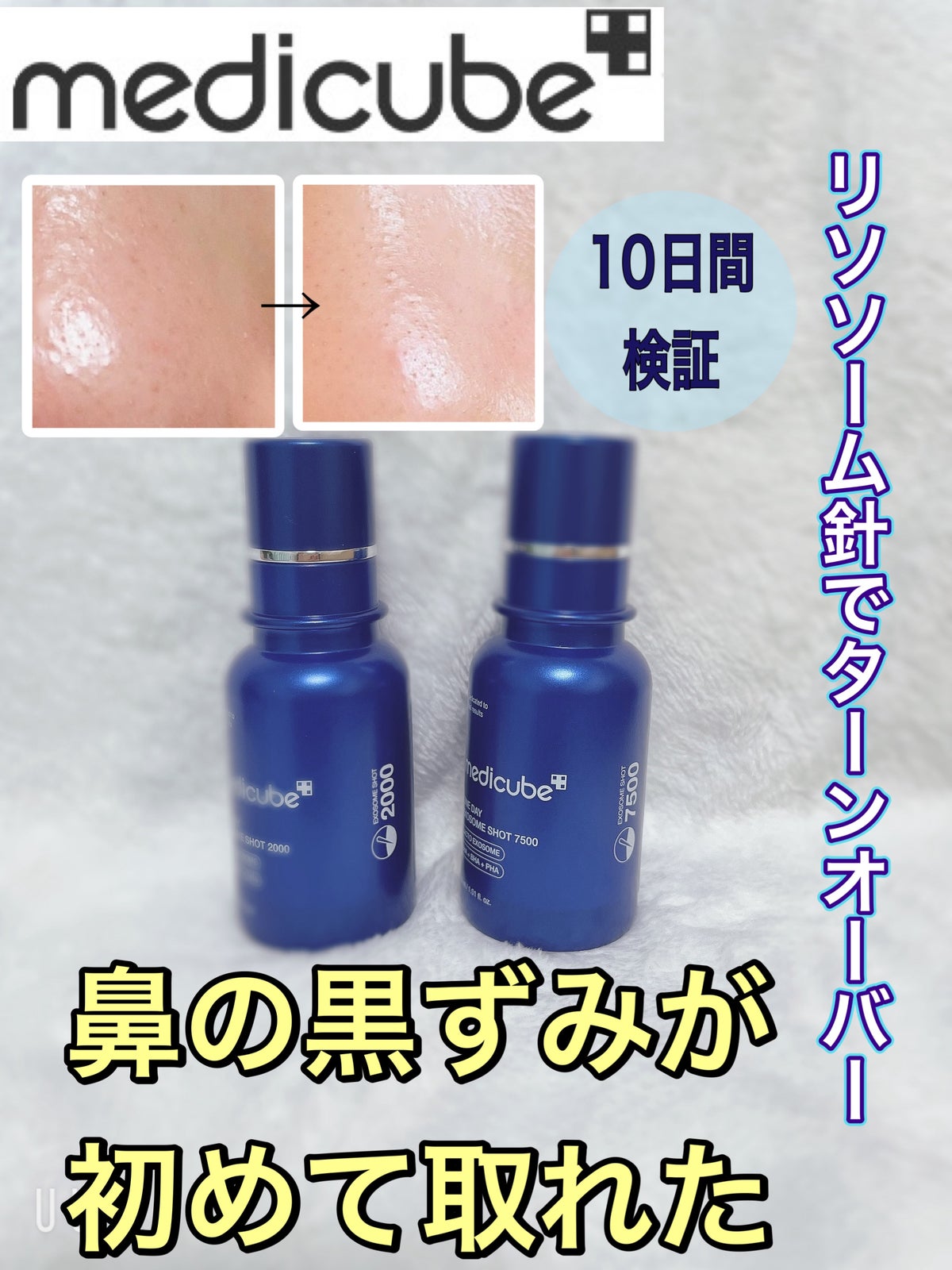 Medicubeの美容液 ゼロ1dayエクソソームショット2000他、1商品を使った口コミ 初めて効いた黒ずみ毛穴ケア🥺メディキューブの新作