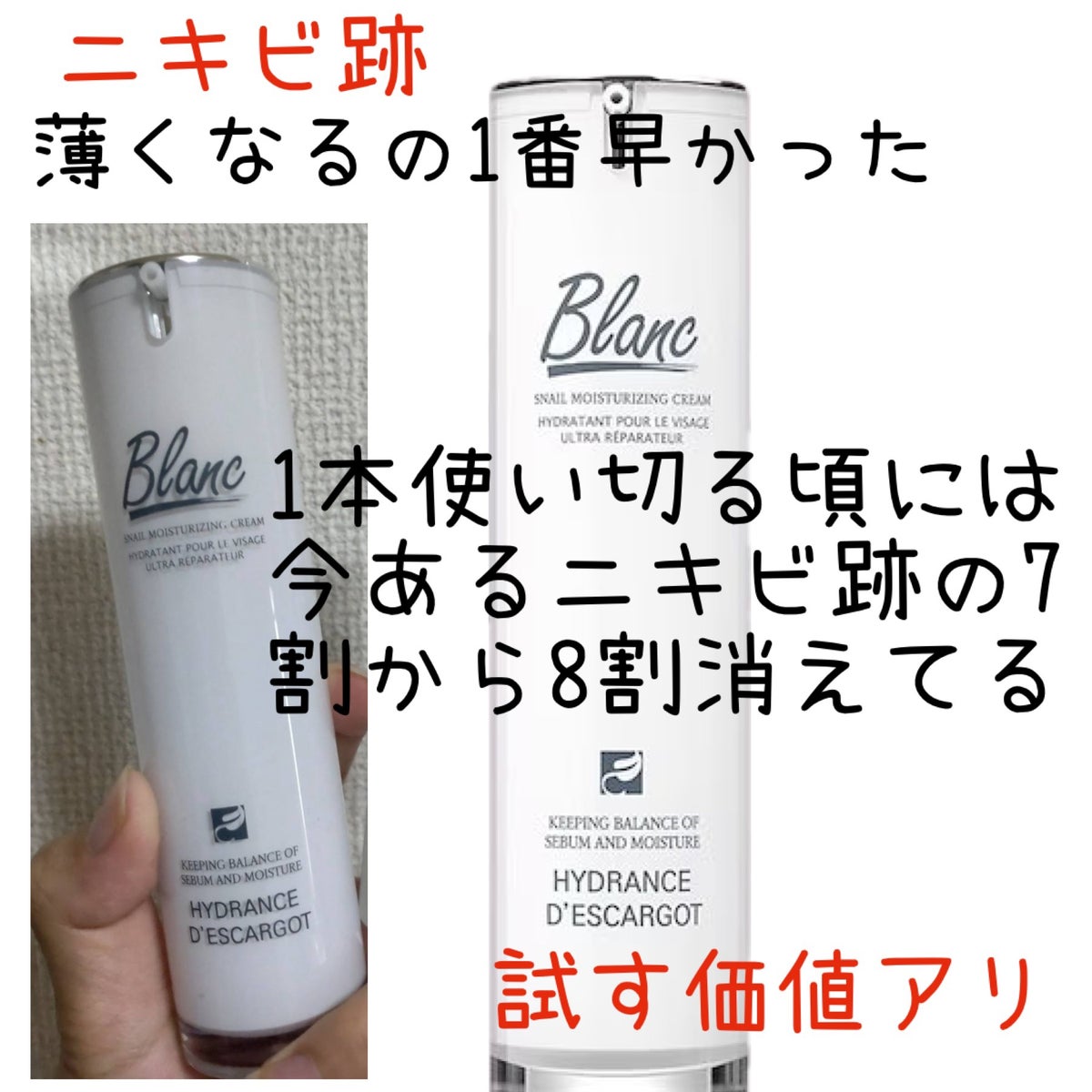 マジックカタツムリクリーム|ブランの効果に関する口コミ ニキビ跡1位って見て、藁にもすがる思いで使ったクリーム。 By きゅーびー混合肌