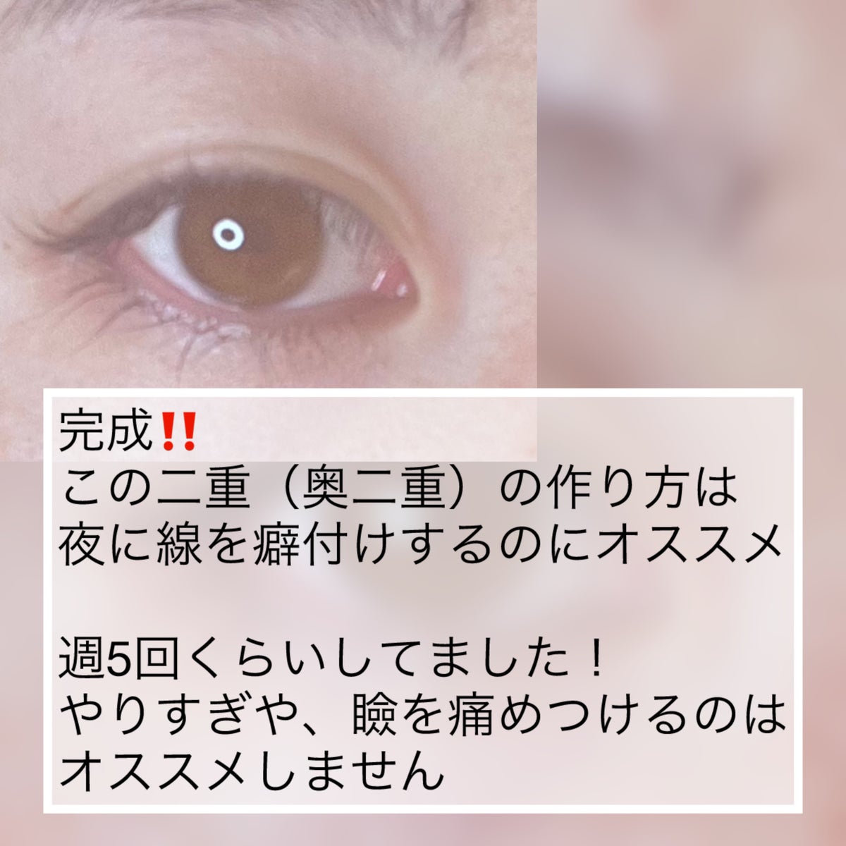 《二重になる方法》ワンダーアイリッドテープ Extra|d Upの使い方や二重メイク 3年間くらいは週5くらいで行っていた、二重の線を付ける