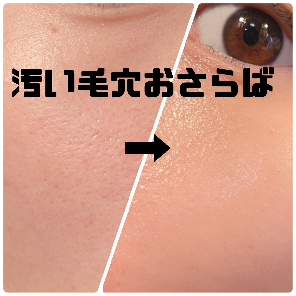 洗顔だけじゃない+パックもできる洗顔料 ホワイトプレミアム|one Stone Two Birdsの口コミ 洗顔だけじゃない。パック、導入