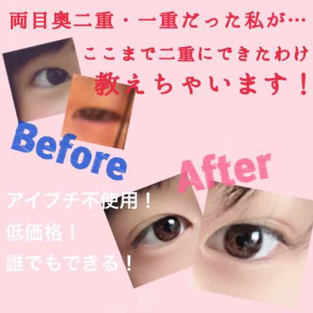 アイテープ 埋没式両面テープ|daisoの効果に関する口コミ「超優秀!100均で買えるおすすめ二重まぶた用アイテム!初投稿です😳 私は小6