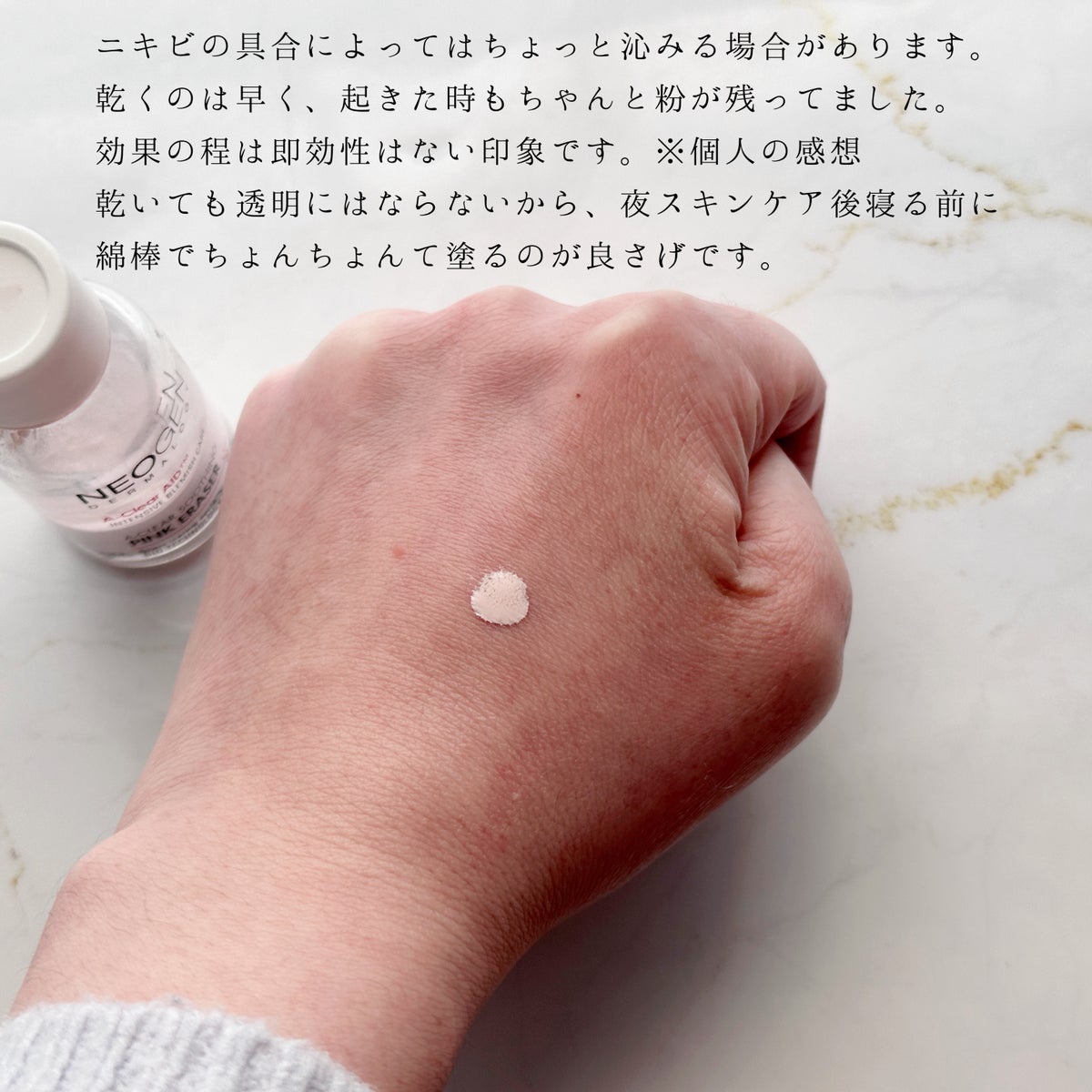 ダーマロジ A Clear スージングピンクイレイザー|neogenの効果に関する口コミ 💓気になってたカラミンパウダーためしてみた