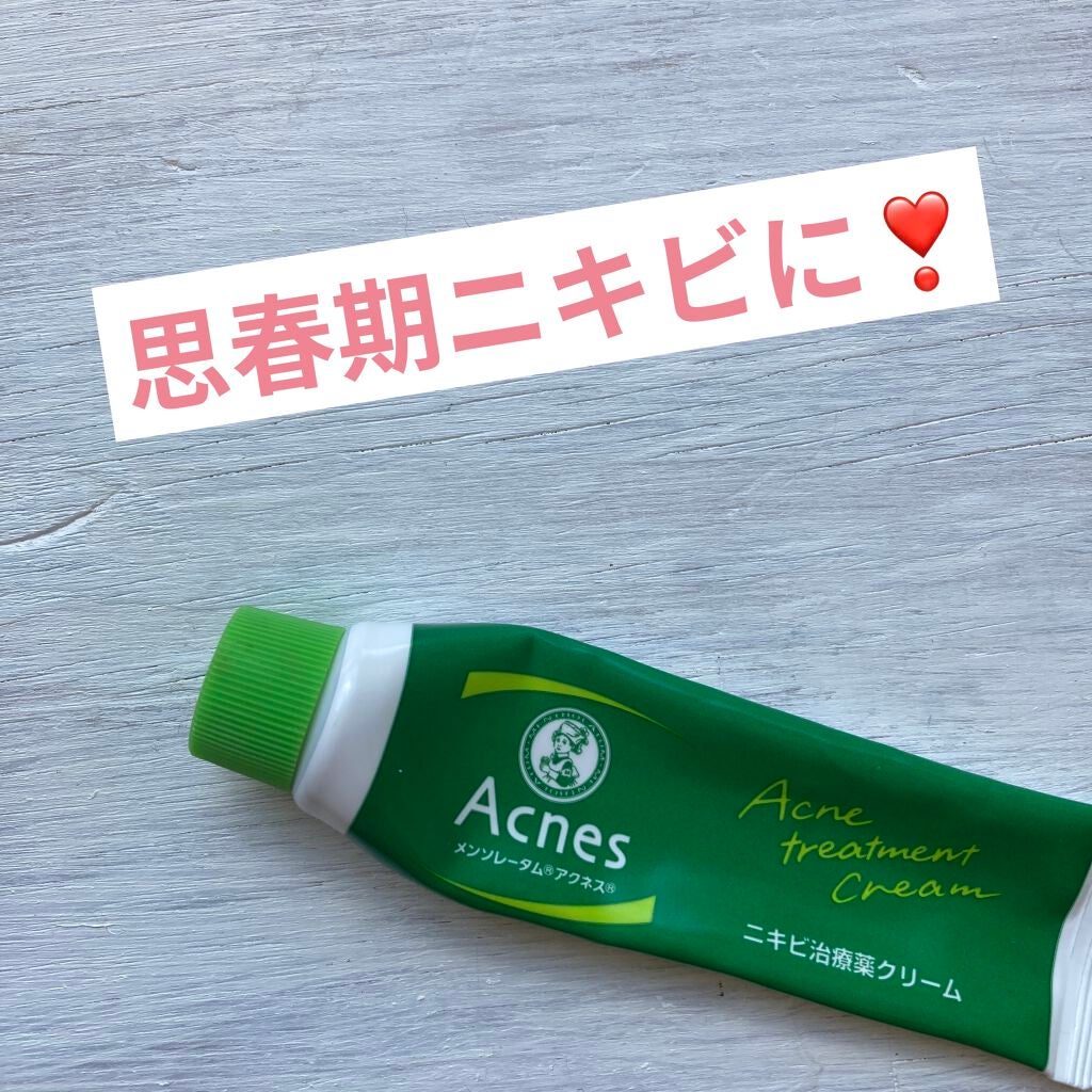 ニキビ治療薬医薬品|メンソレータム アクネスの口コミ「こんにちは〜きと ︎です 今回、私のほっぺ」 By きと混合肌 Lips
