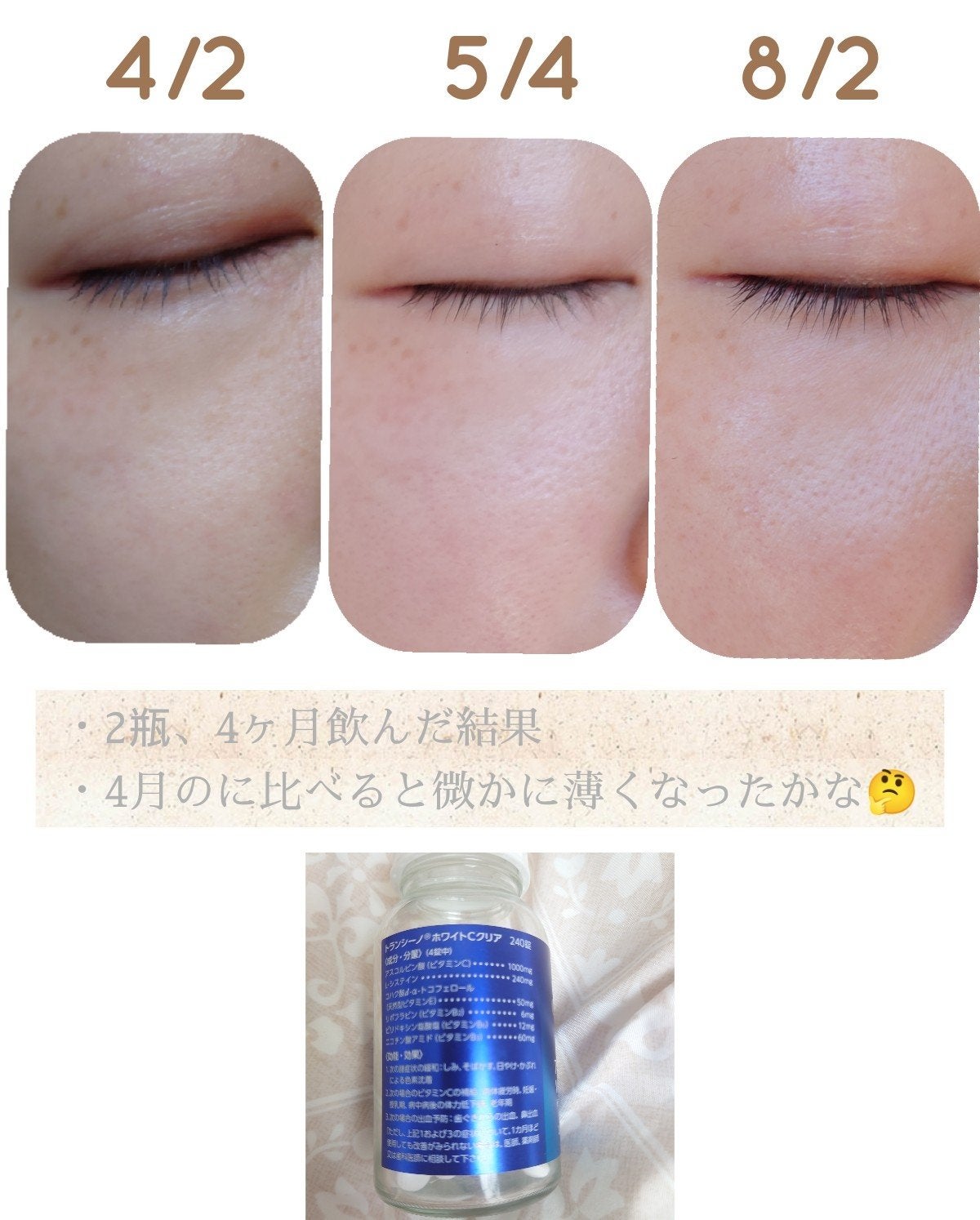 ホワイトcクリア医薬品|トランシーノ他、1商品を使った口コミ トランシーノホワイトcクリア By Colorfulmake