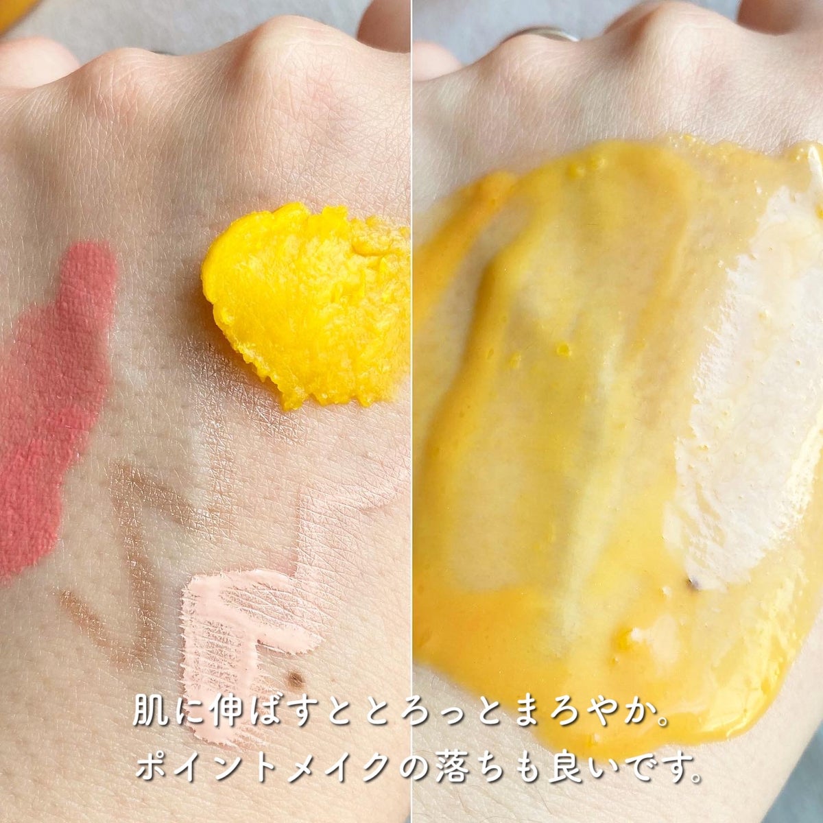 カロテンipmptm とろけるクレンジングバーム |aprilskinの効果に関する口コミ ニキビケアにおすすめのクレンジングバーム