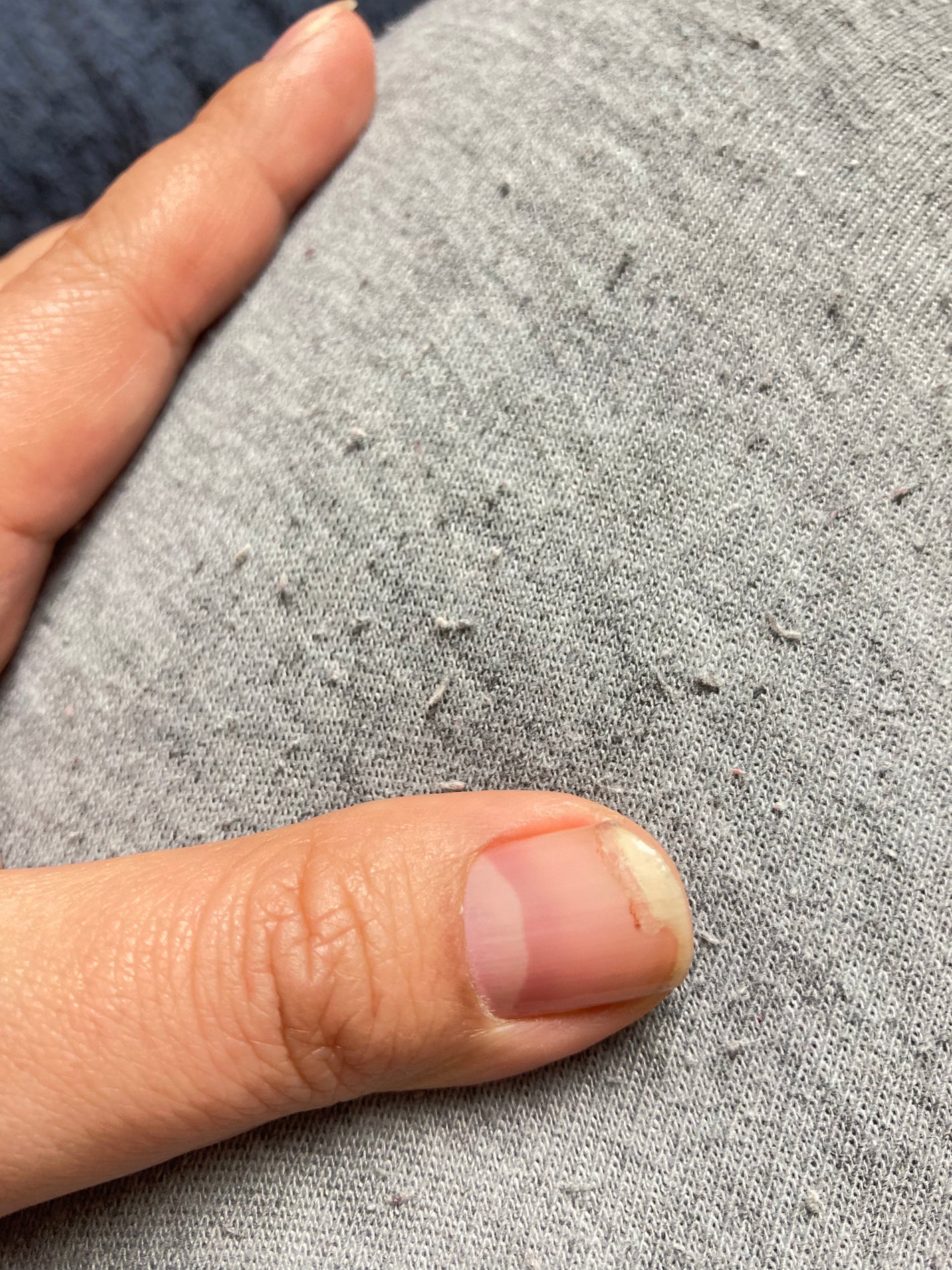 長さ出しジェル|セリアの口コミ 超優秀!100均で買えるおすすめジェルネイル!俺ちゃん左利きの聞き手の爪が四つ折れになりして。始末後が1枚