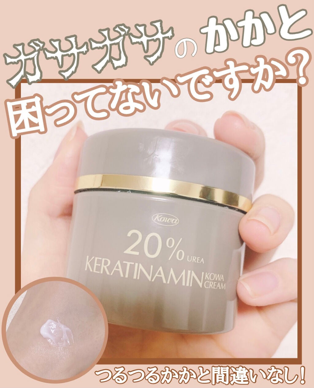 コーワ20%尿素配合クリーム医薬品|ケラチナミンの効果に関する口コミ かかとのガサガサによく効く、ケラチナミンコーワ20%尿素配合