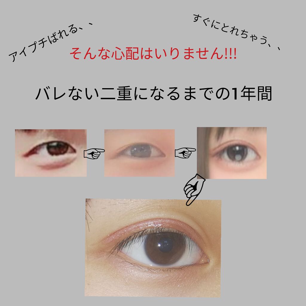 《二重になる方法》アイトーク|アイトークの使い方や二重メイク ななこちゃん方式三重論!!! 私は昔から結 By 🐦👵混合肌10代後半