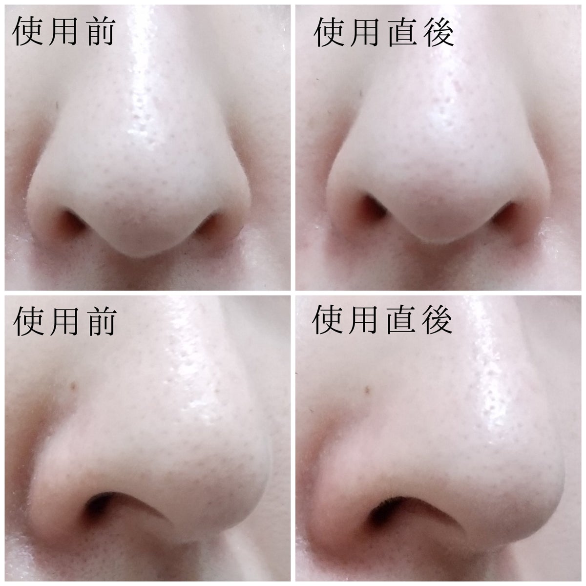 鼻 バブルパック|cnp Laboratoryの辛口レビュー 【小鼻の黒ずみ、優しくケア】 By Hana混合肌 Lips