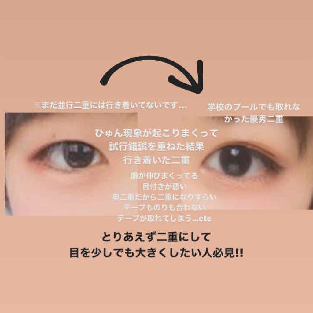 《二重になる方法》アイテープ(絆創膏タイプ、レギュラー、70枚)|daisoの使い方や二重メイク 今年高校1年生のいわゆるjkです笑