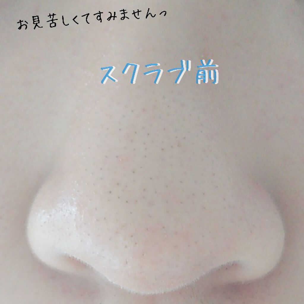 温感スクラブジェル|daisoの効果に関する口コミ 超優秀!100均で買えるおすすめクレンジングジェル!ダイソーの温感スクラブジェル、実際