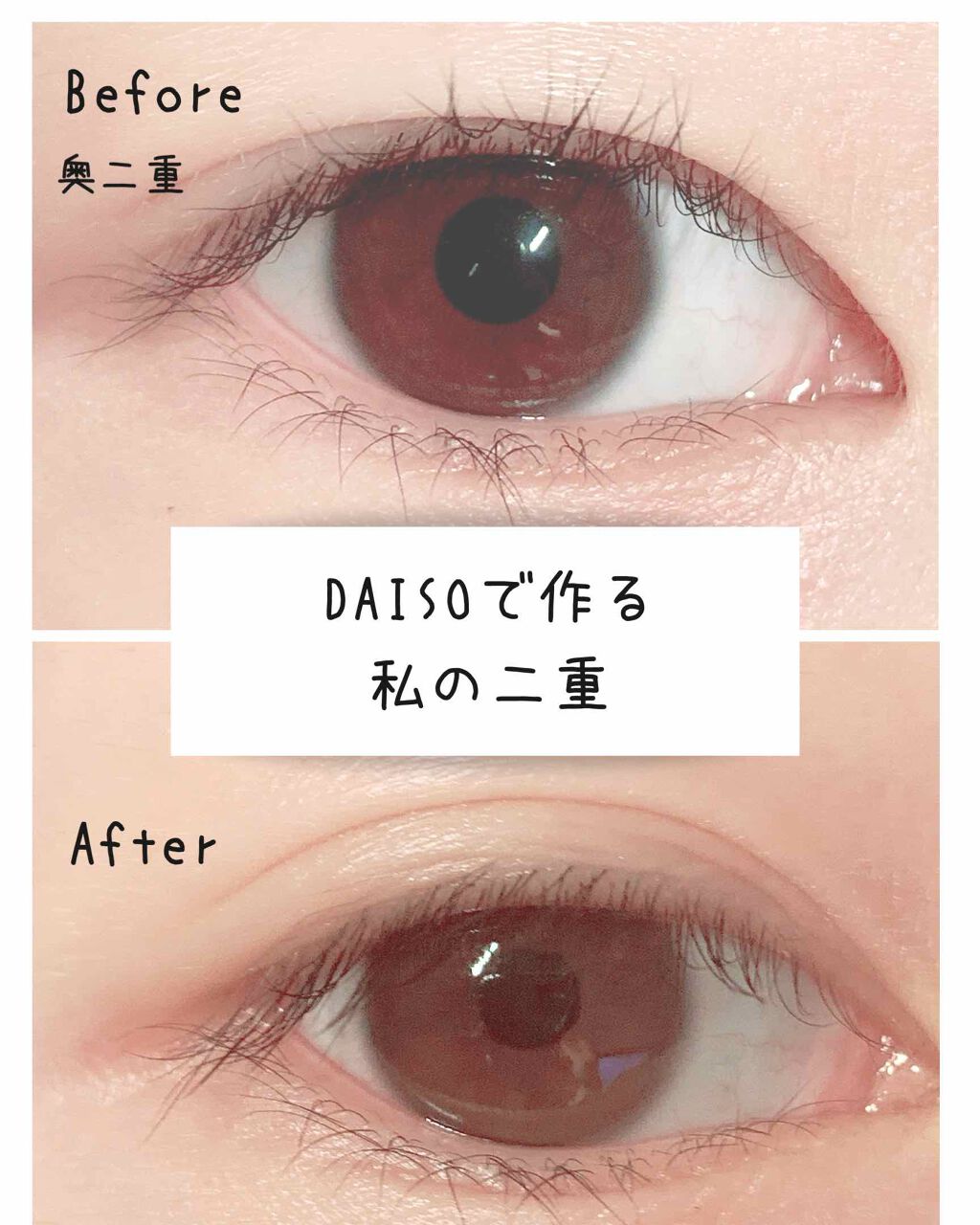 二重まぶた用シール|daisoの使い方を徹底解説 超優秀!100均で買えるおすすめ二重まぶた用アイテム! Daisoで作る私の二重! By