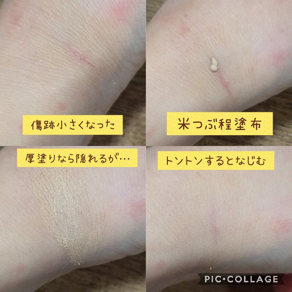 アットノン コンシーラータイプ医薬品|アットノンの口コミ アットノン コンシーラータイプ!これは素晴らしかった😊 By さより