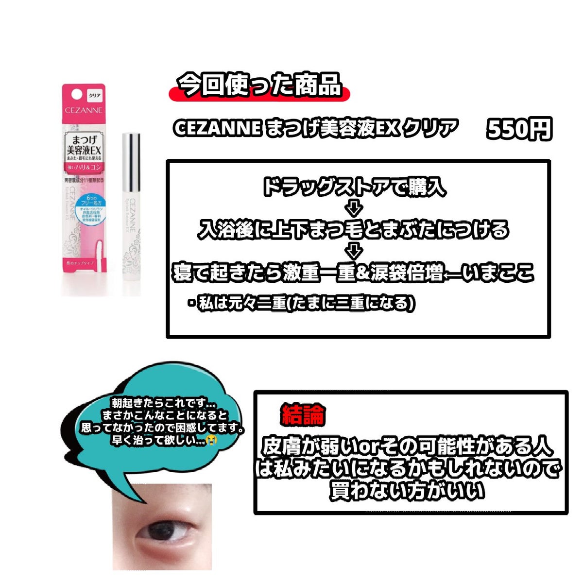 まつげ美容液ex|cezanneの口コミ Cezanne まつ毛美容液ex クリア By 量産型地雷系ヲタクフォロバ100普通肌