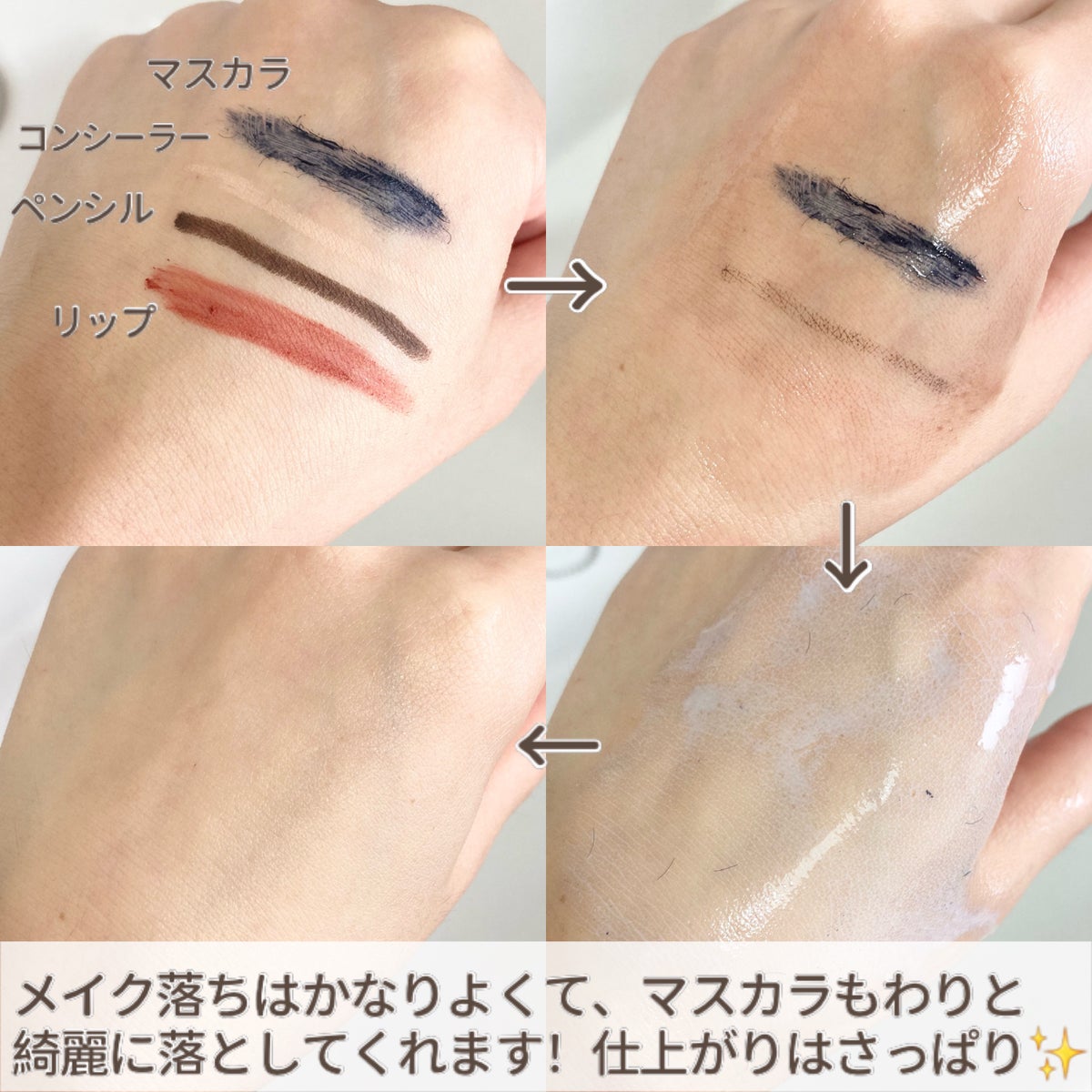 Choiクレンジングオイル 薬用ニキビケア|肌美精の効果に関する口コミ ニキビケアにおすすめのオイルクレンジング!コスパと仕上がり最強の