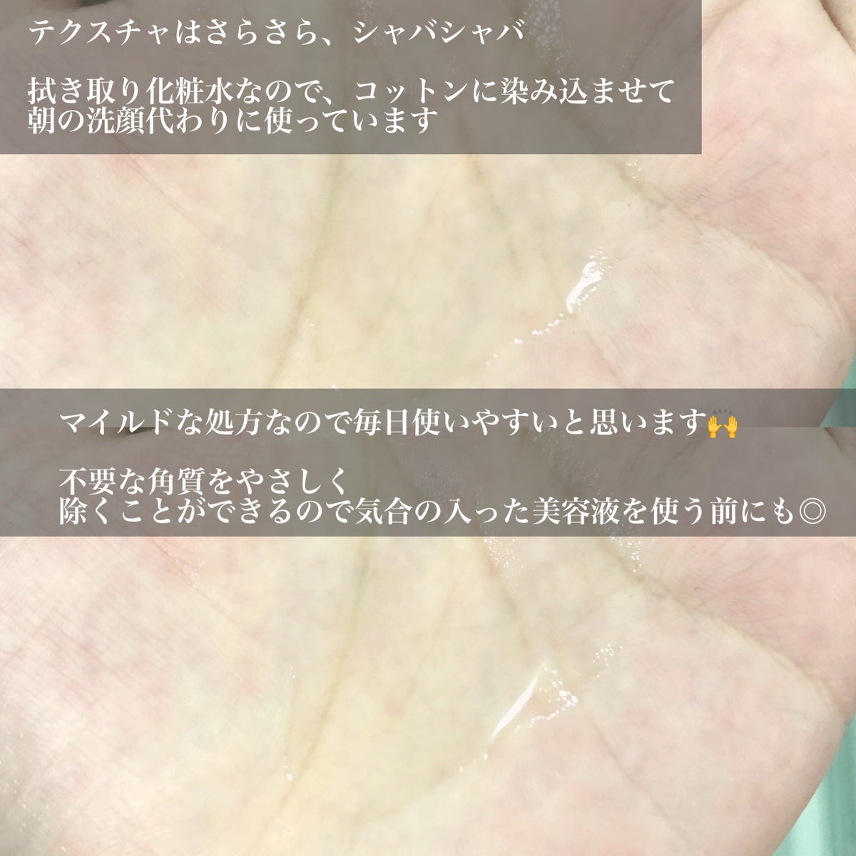 Cicaピュリファイング トナー|ロベクチンの口コミ マイルド処方の拭き取り化粧水🧴 By ちっく*フォロバ混合肌 Lips