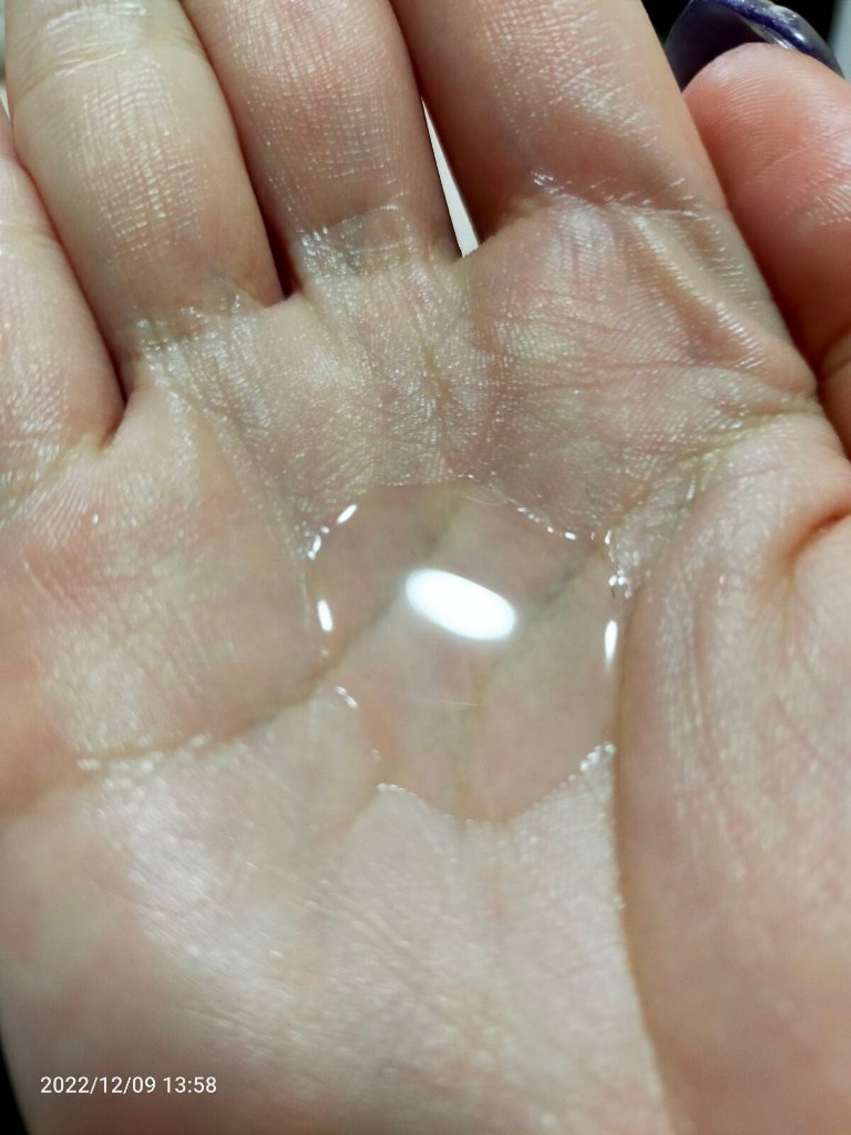 極潤プレミアムヒアルロン液ハダラボスーパーモイスト化粧水c|肌ラボの口コミ 乾燥肌におすすめの化粧水!ヒアルロン酸とは ヒアルロン酸は