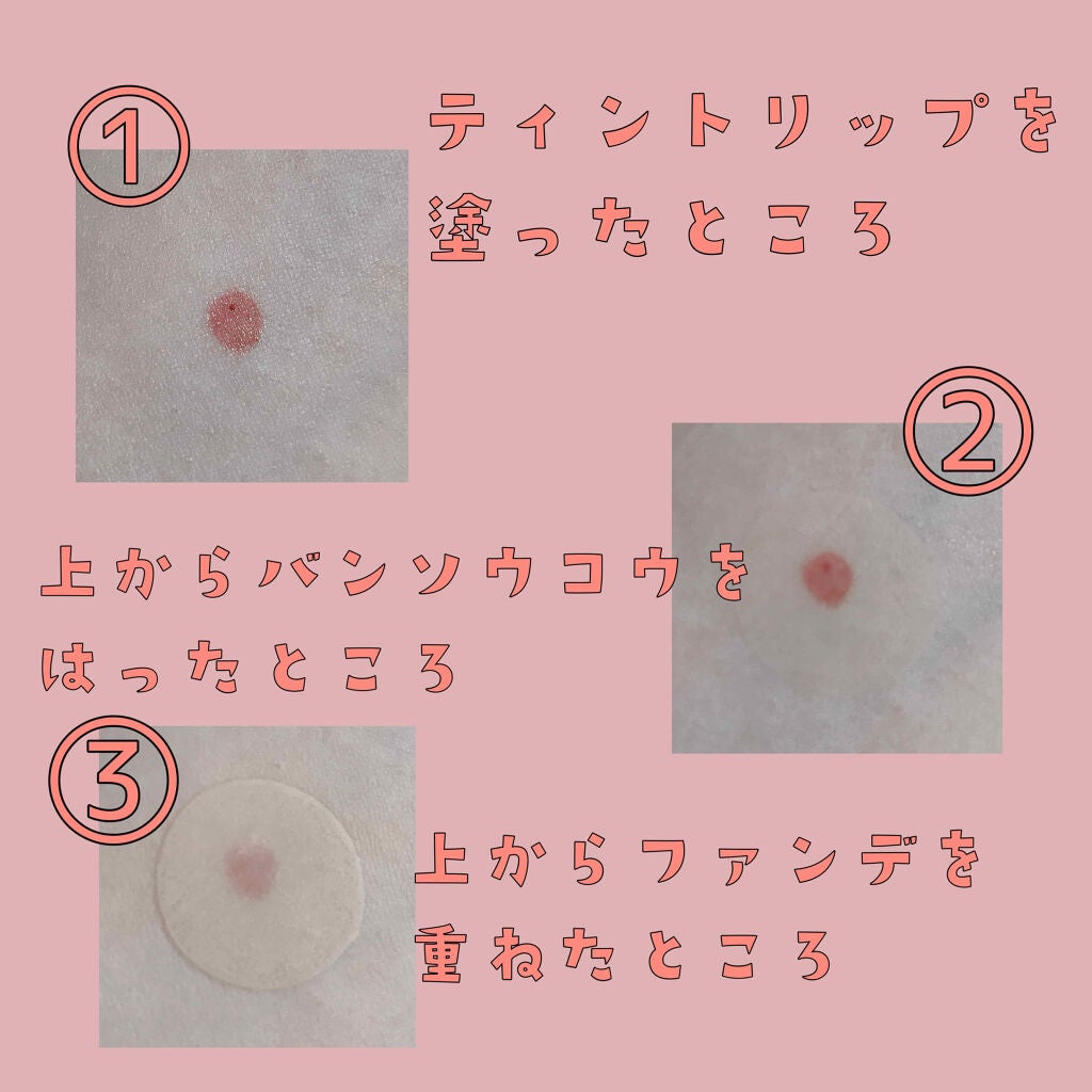 キズを早くきれいに治すパッチ|matsukiyoの効果に関する口コミ ⭐️matsukiyo キズを早くきれいに治すパッチ⭐️ By