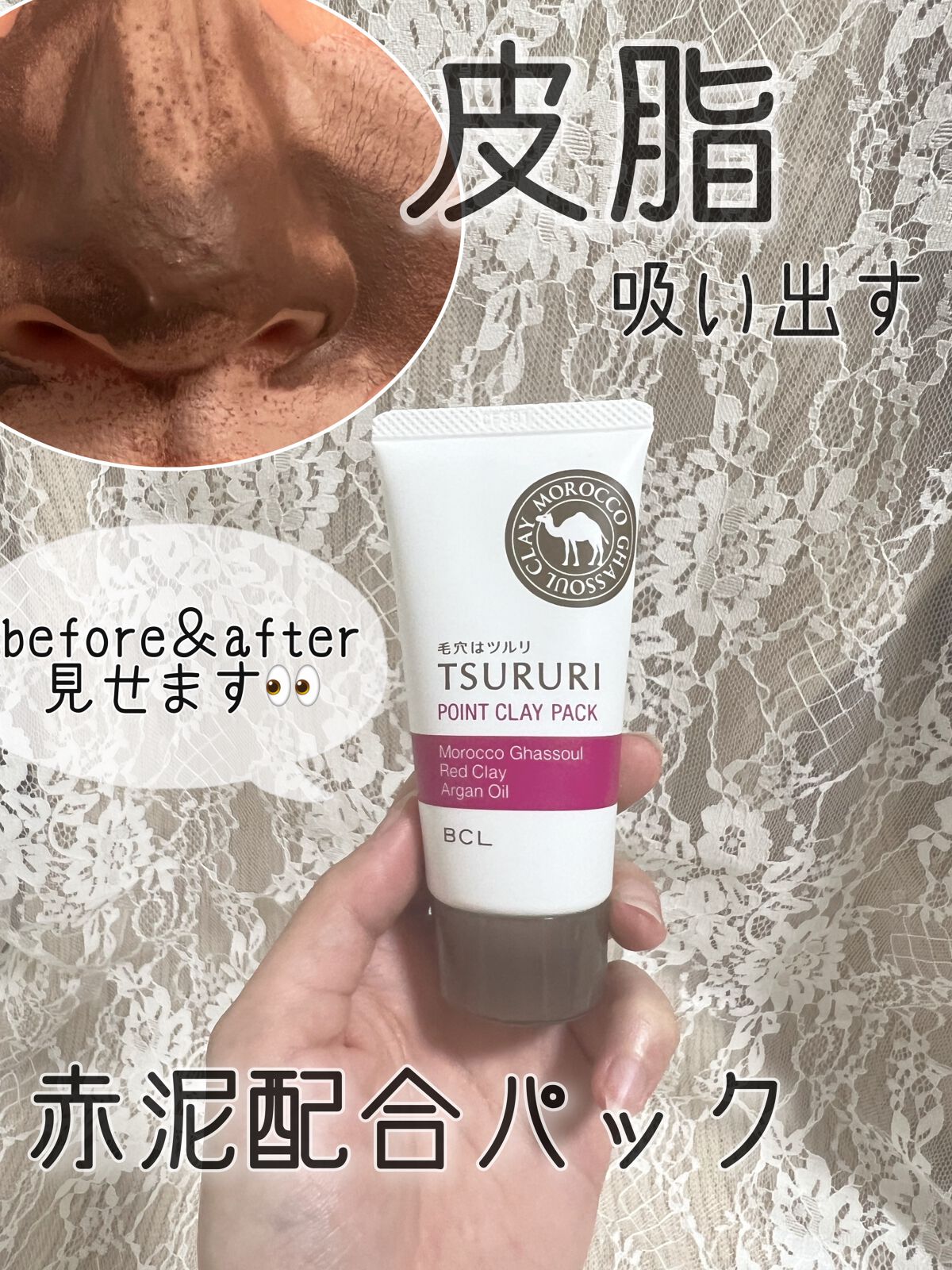 皮脂吸い出し 部分用パック ガスール&レッドパワー|ツルリの口コミ 【毛穴ケア👃泥パック使ってみた👀】 By のののん♪乾燥肌20代