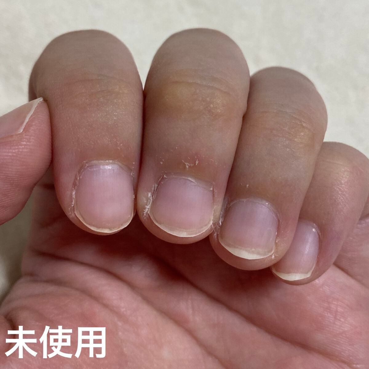 Ferment Placenta ネイルケアオイル〈ネイルエッセンス〉3ml|ブラン製薬の口コミ ブラン製薬 Ferment