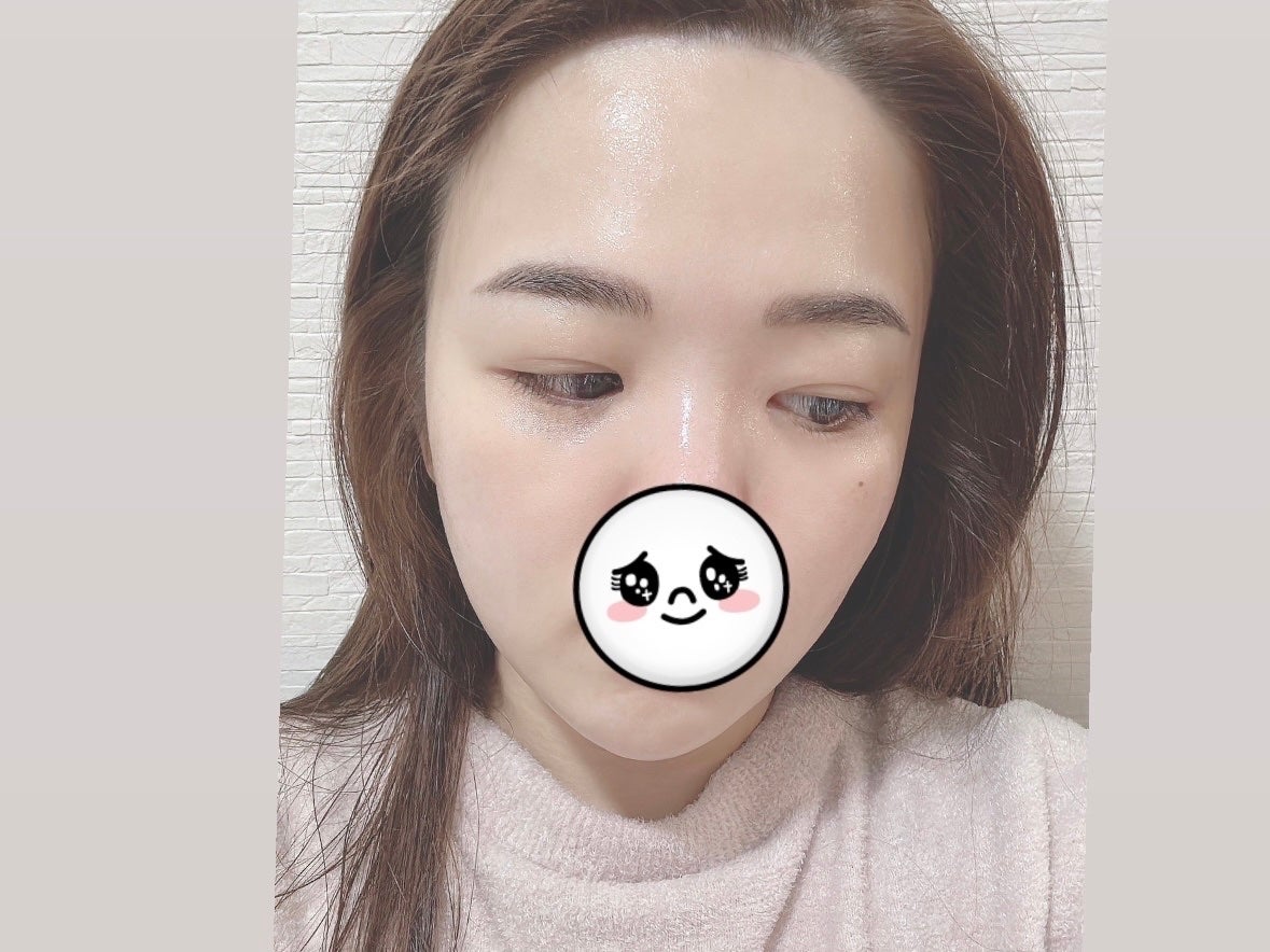 プロポリス エナジーアンプル セラム|cnp Laboratoryの口コミ 敏感肌におすすめの美容液!つやつやで光ってて脱毛直後みたいな肌