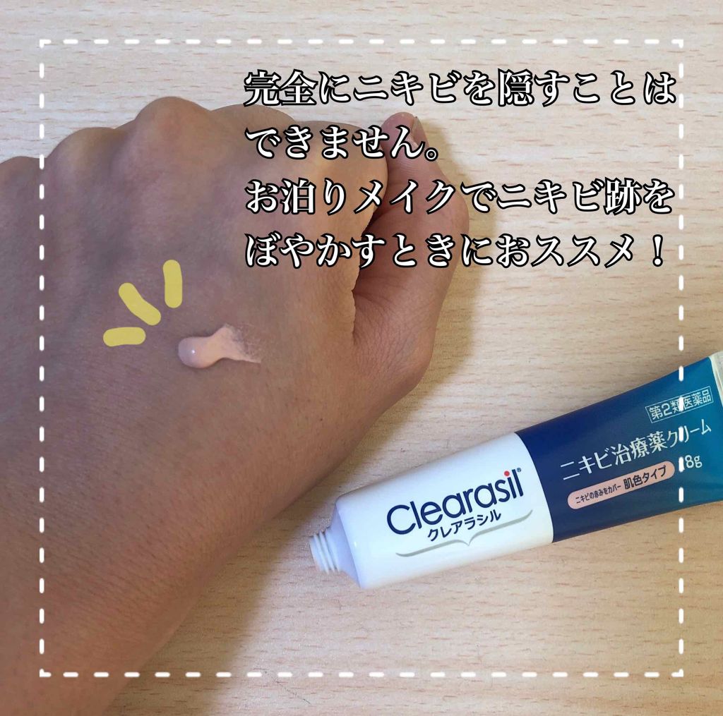 ニキビ治療薬クリーム 医薬品|クレアラシルの口コミ 今回は クレアラシルのニキビ治療薬クリーム肌色タイプをレビューします! By