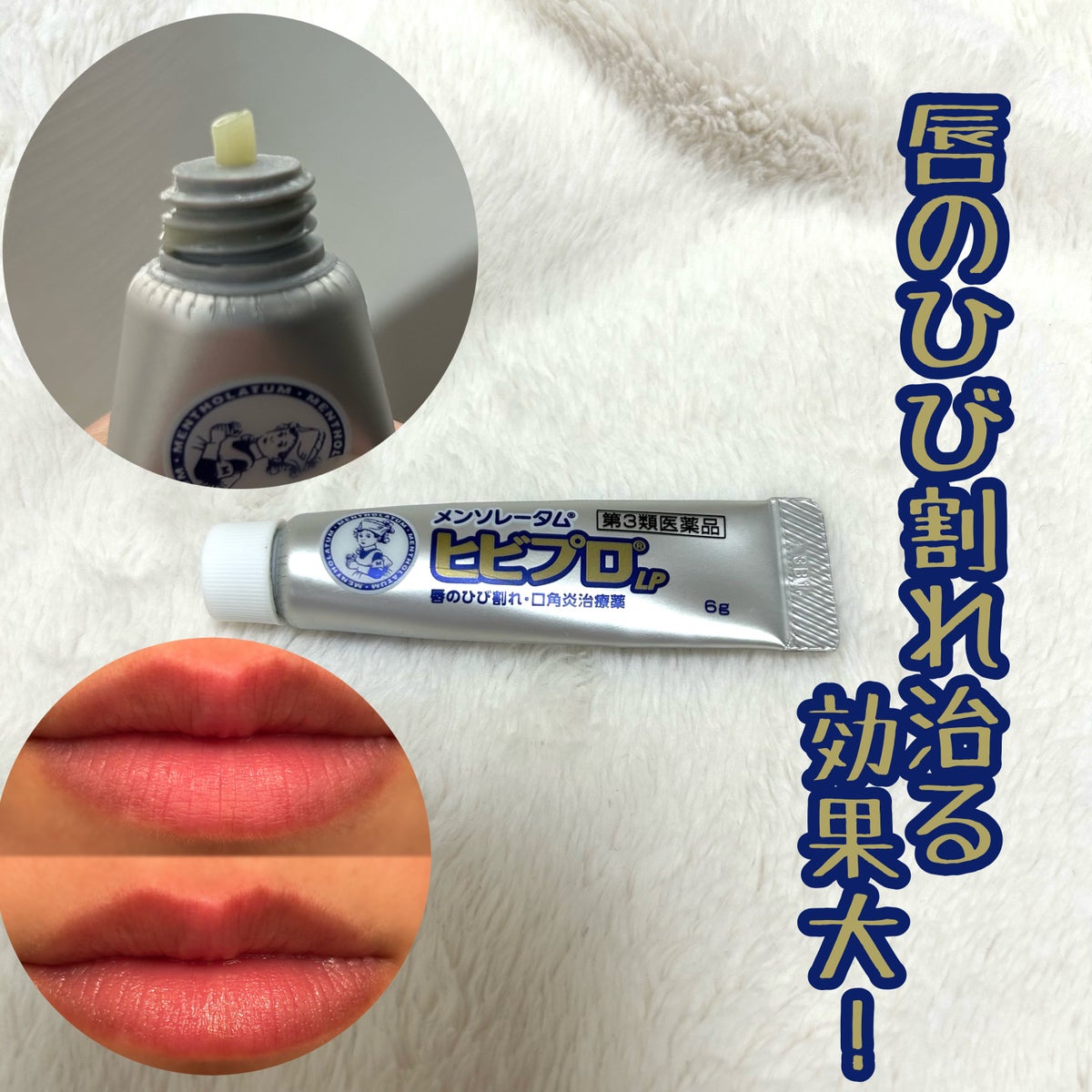 ヒビプロlp医薬品|メンソレータムの口コミ リピ商品🔁唇の治安良🫦 Tiktokで By さり乾燥肌20代後半 Lips