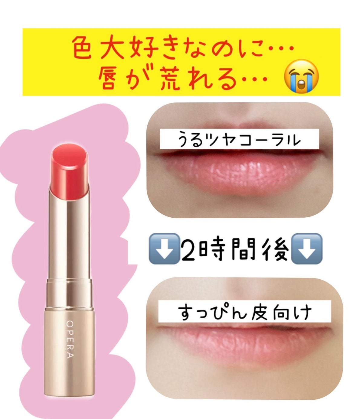 オペラ リップティント N|operaの辛口レビュー オペラのティント私には合いませんでした😌 By めりーちゃん(フォロバ100)混合
