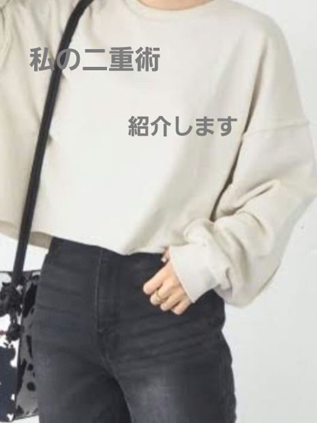 ルドゥーブル・streetrend・アイトーク・d Upの二重まぶた用アイテムを使った口コミ 「私の二重術」 Ng行為もご紹介 By しとら