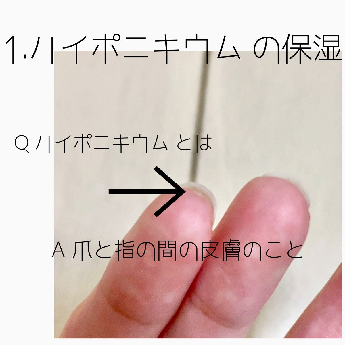 ネイルベッドオイル|アンドネイルの口コミ 約2ヶ月でハイポニキウム を育成 By りゅーい敏感肌20代前半 Lips