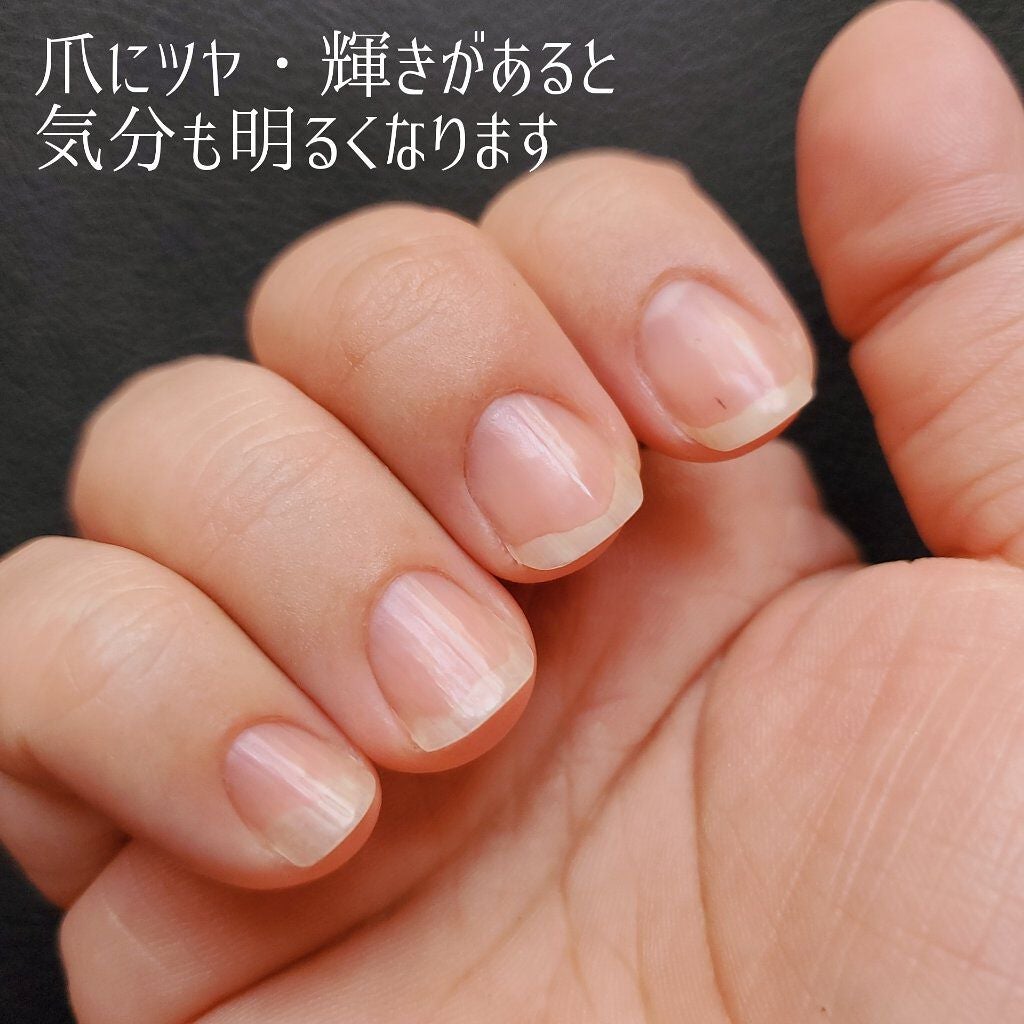 つめみがき|daisoの口コミ 超優秀!100均で買えるおすすめネイル用品!爪甲剥離症の育爪記録 以前の投稿はこちらにあるので By か