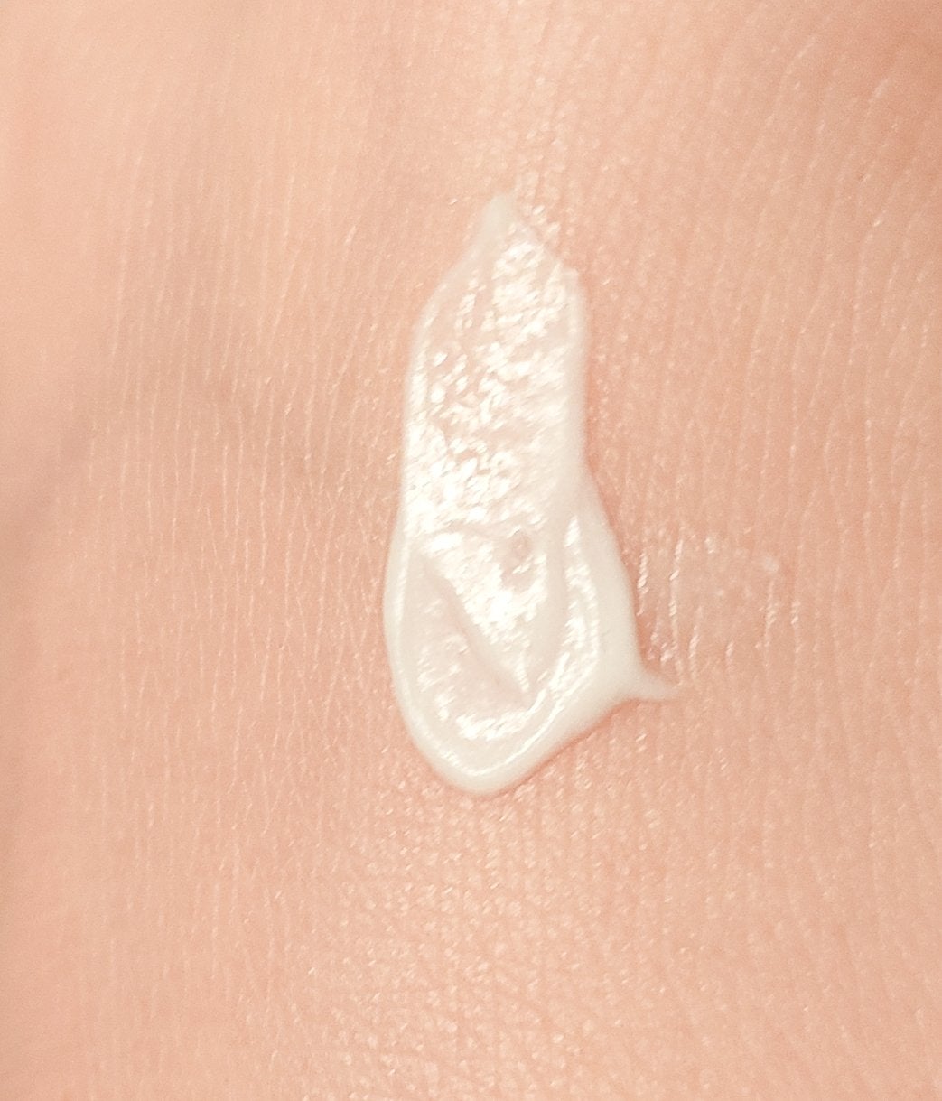 ニキビ治療薬医薬品|メンソレータム アクネスの効果に関する口コミ できてまもない赤くて痛いニキビに塗ると23日でだいぶ薄くなりました