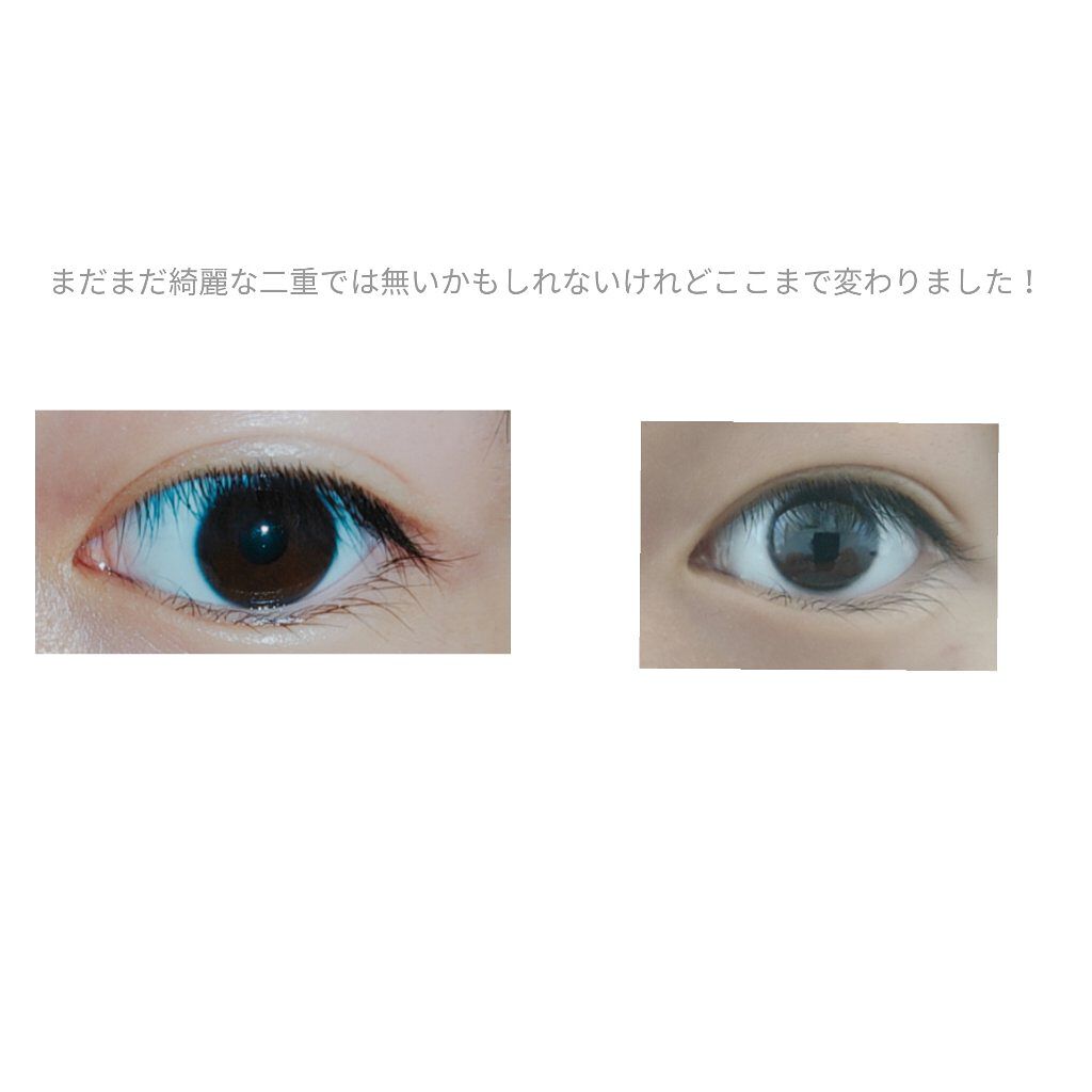 ダブルアイリッド|daisoの口コミ 超優秀!100均で買えるおすすめ二重まぶた用アイテム!初めましてこんにちは! 今回は一重が二重になっ