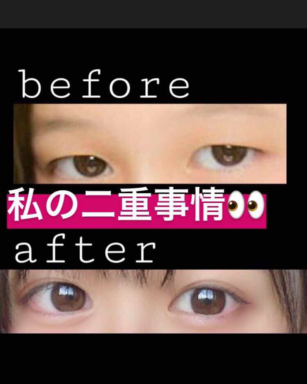 のび〜る アイテープ 両面テープタイプ|daisoの口コミ 超優秀!100均で買えるおすすめ二重まぶた用アイテム!1枚目の写真は同一人物の