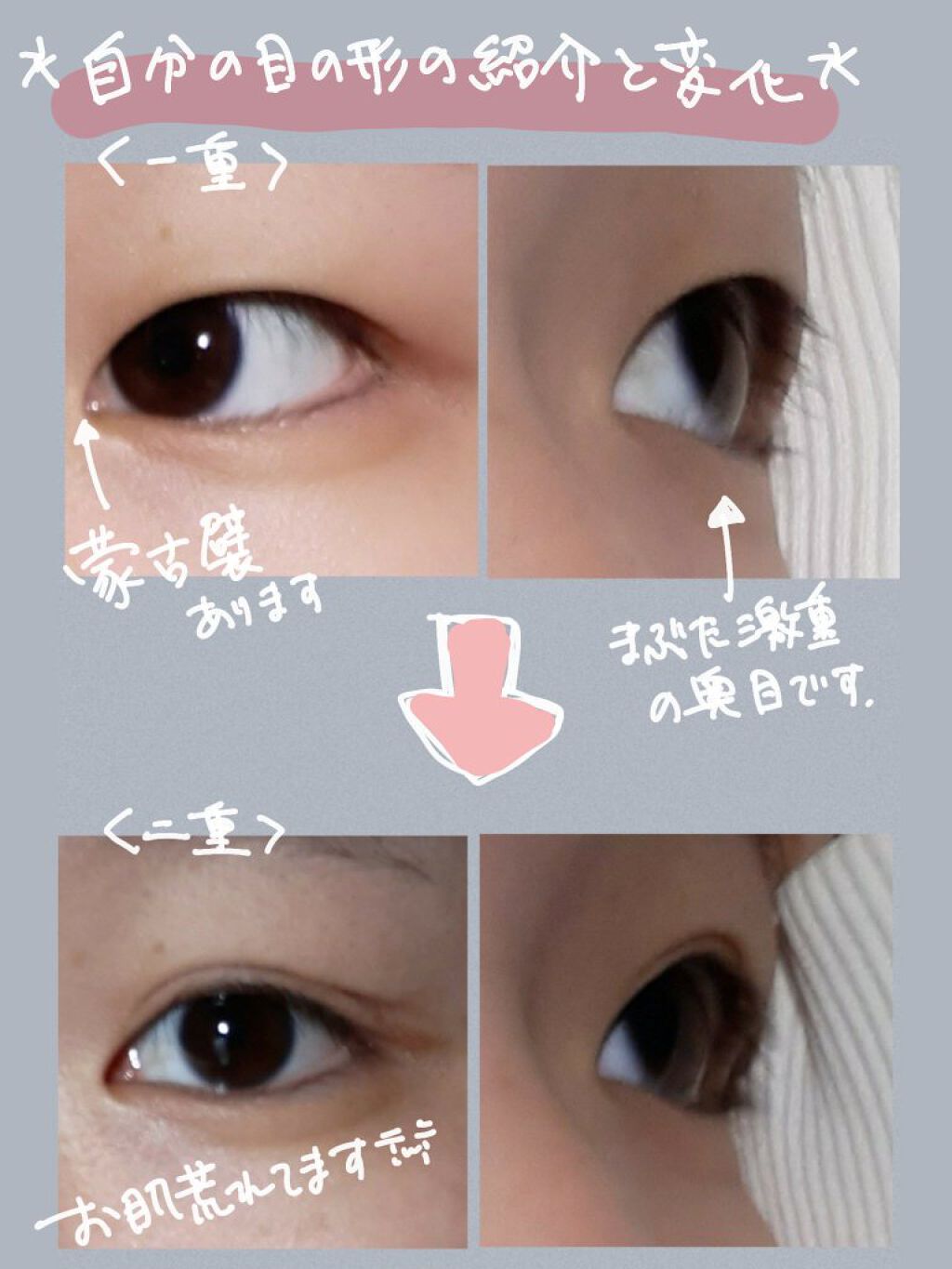 アイテープ(絆創膏タイプ、レギュラー、70枚)|daisoの口コミ 超優秀!100均で買えるおすすめ二重まぶた用アイテム!激重一重さん必見