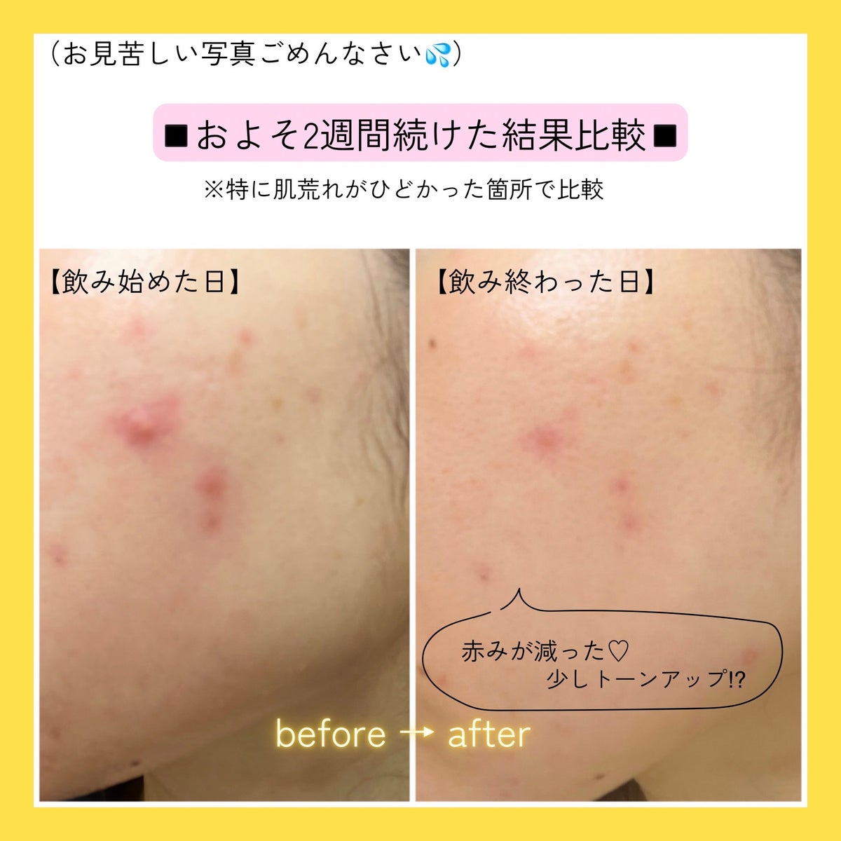 ビタミンc「2000」|武田薬品工業の辛口レビュー 🫧アリナミン製薬 🫧ビタミン「c2000」 By とうふ🍪乾燥肌20代後半 Lips