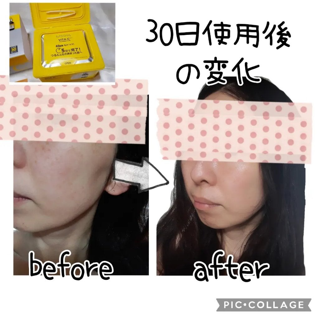 ビタシープラス デイリーマスク|misshaの口コミ 515にミシャのシートマスク By Yandy フォロバ100混合肌30代後半