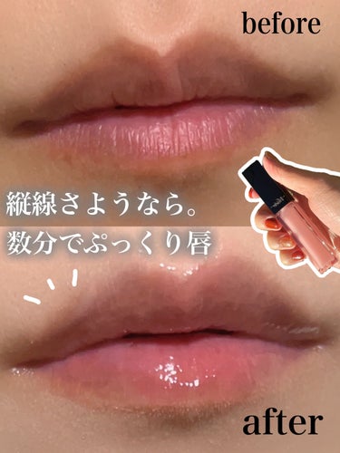 エッセンス リッププランパー|viséeの口コミ Visée エッセンス リッププランパー By Mii🐘🌿フォロバ100混合肌30代前半 Lips