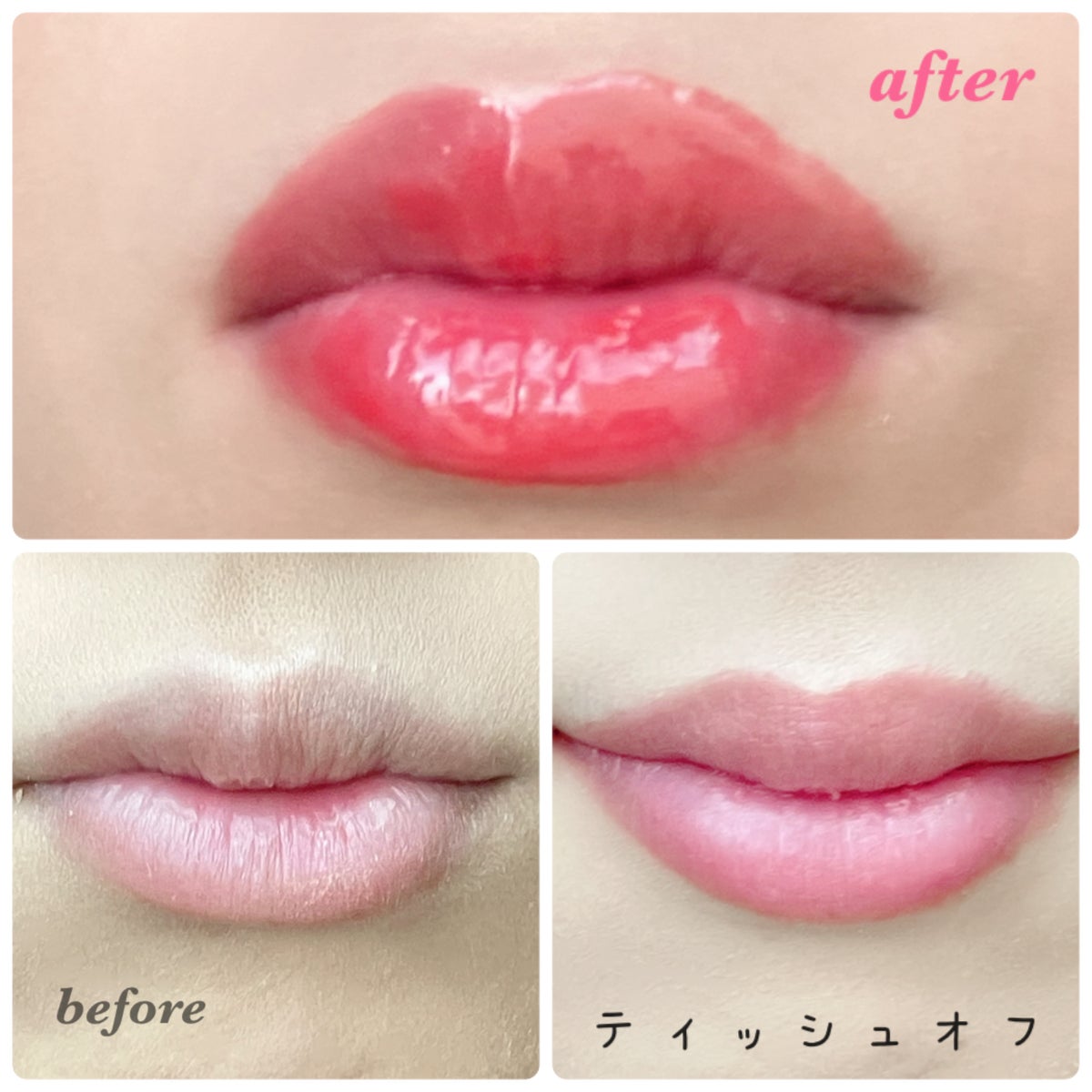Dotom Lip Plus Plumper|keyboの口コミ 刺激強め ドトム リッププラス プランパー 高段者神 By もか