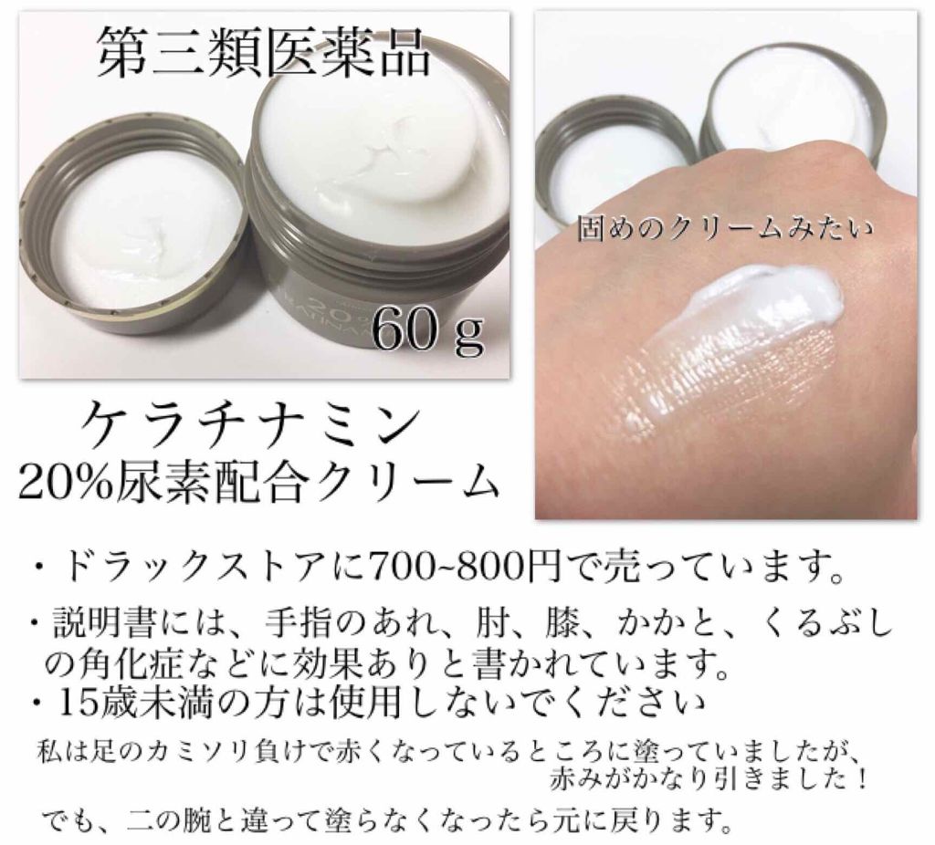 コーワ20%尿素配合クリーム医薬品|ケラチナミンの効果に関する口コミ 二の腕のブツブツが気になる人に是非使ってほ By びす子敏感肌