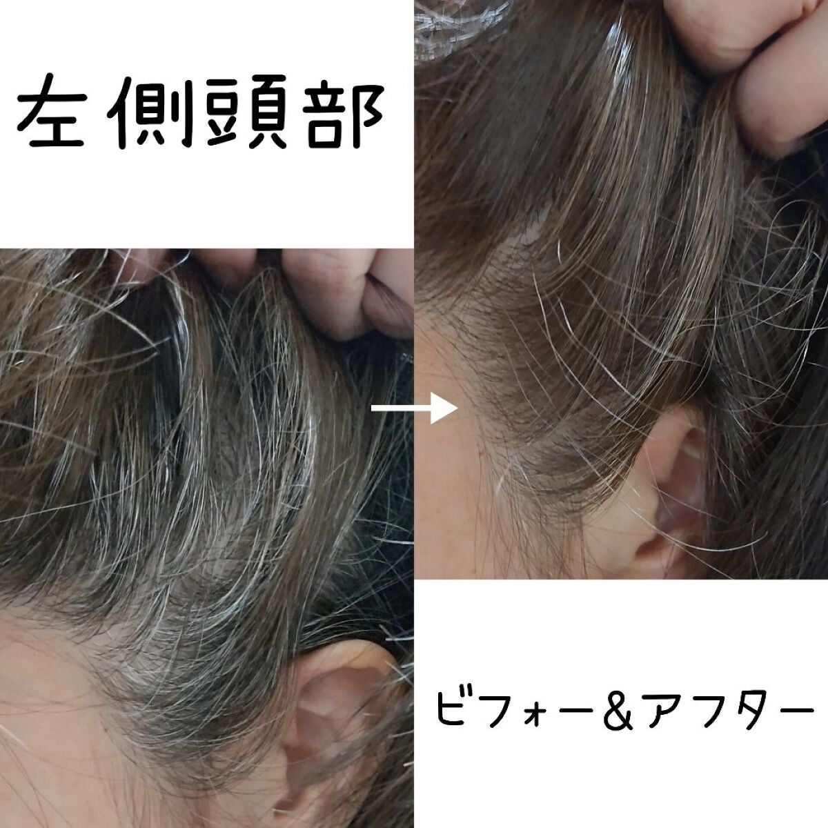 泡カラー 白髪用|ブローネの口コミ 昨日、毛染めしました。 ちょっと大事なお出掛け前にする By コンパス混合肌40代後半 Lips