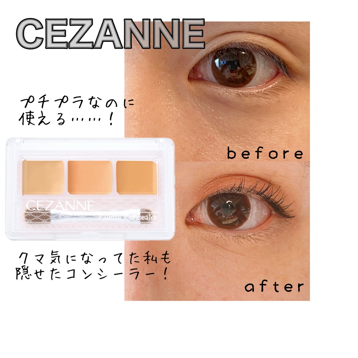 パレットコンシーラー|cezanneの口コミ ※屋内撮影ダイニングライト黄色めのため By Yuitasuuu🌻脂性肌30代前半