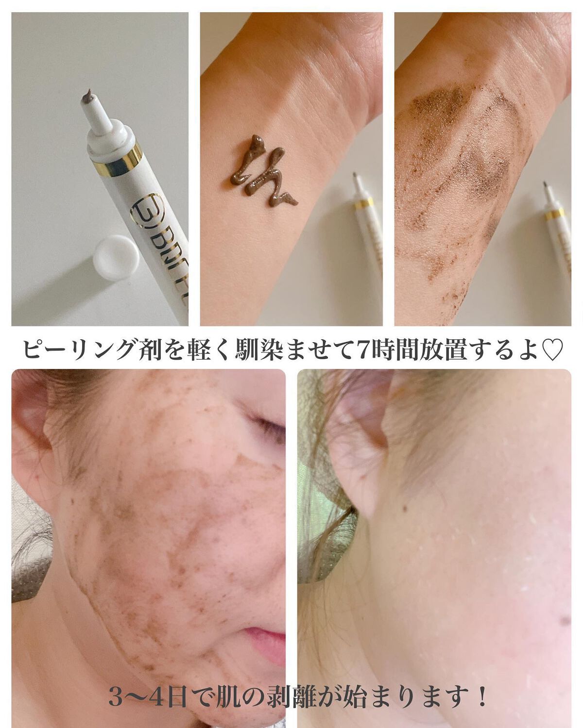 ダーマスキンピーリング|bqcellの使い方を徹底解説 Bqcell ダーマスキンピーリング By Ykes乾燥肌40代前半 Lips
