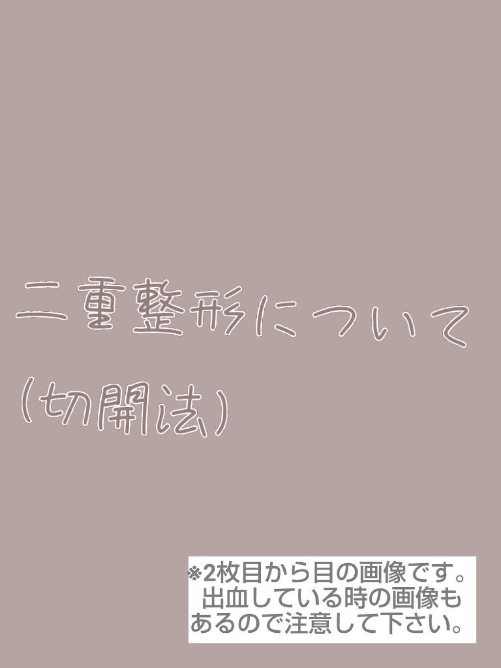 Daiso・シェモア・d Upの二重まぶた用アイテムを使った口コミ ココアです 二重整形のdtが終了しました By ココアフォロバ100